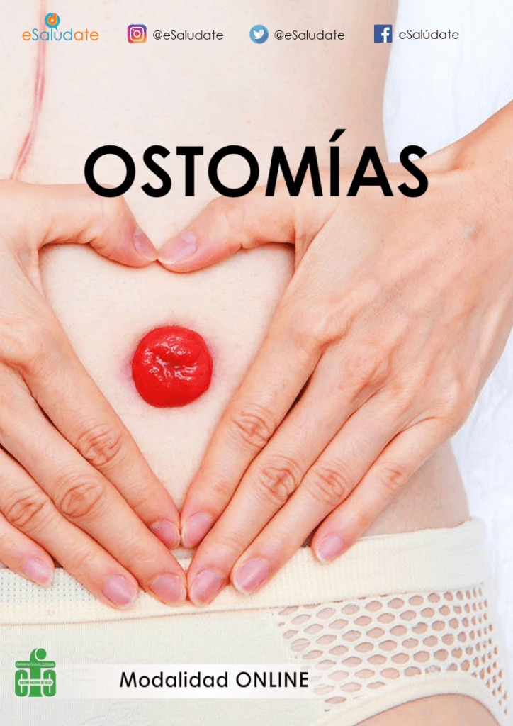 Ostomías - eSalùdate